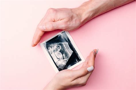 초음파 이미지 임신 한 아기 사진 분홍색 배경에 초음파 임신 사진을 들고 여자 손 임신 의학 약학 건강 관리 및 사람 개념 2명에 대한 스톡 사진 및 기타 이미지 Istock