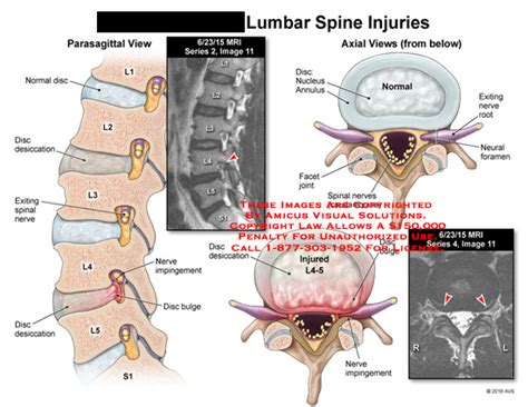 Medical Exhibits Demonstrative Aids Illustrations And Models