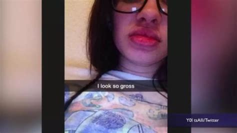 Kylie Jenner Lip Challenge Leaves Terrifying Results Haberler