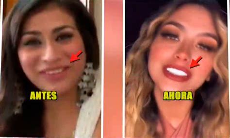 La Transformación De Fátima Segovia Imágenes De Su Antes Y Después Atv