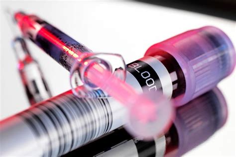 Screening For Downs Syndrome And Edwards And Pataus Syndromes Madeformums