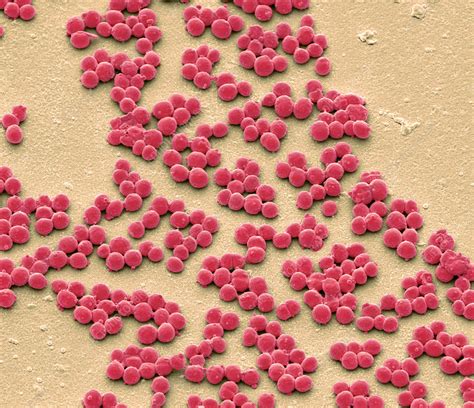 Group A Streptococcus Bacteria Sem Stock Image C Science Photo Library