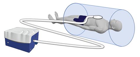 Mr Elastography Practical Questions From The Ajr Special Series On