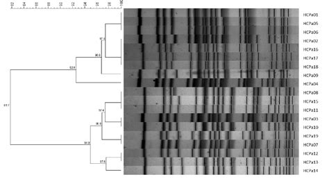 Figure 1 From Outbreak Of Pseudomonas Aeruginosa High Risk Clone St309 Serotype O11 Featuring