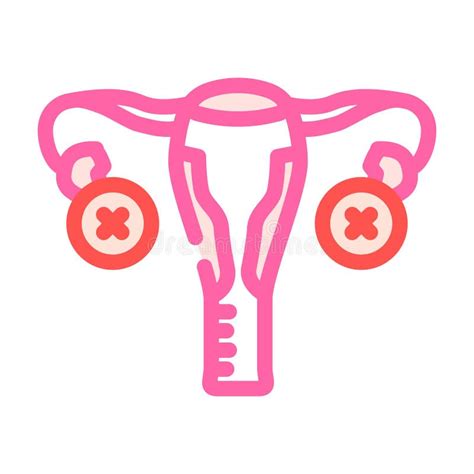 Oophorectomy Surgery Color Icon Vector Illustration Stock Illustration