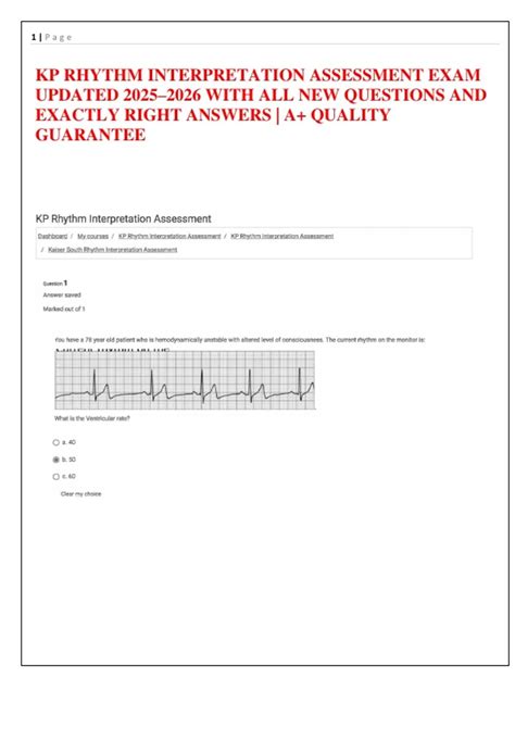 Kp Rhythm Interpretation Assessment Exam 20252026 Ecg Practice