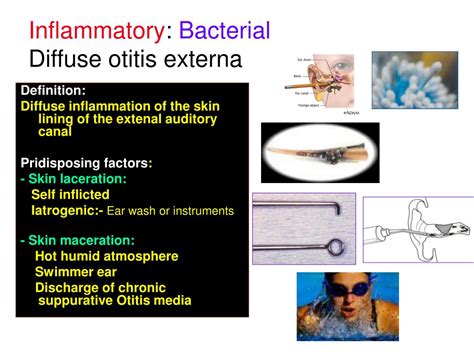 Ppt External Canal Powerpoint Presentation Free Download Id945631