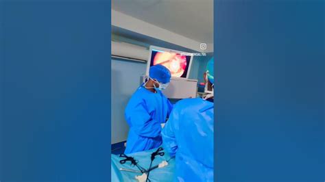 Lap Cholelithiasis Shortvideo Hospital Viralvideo Nursing