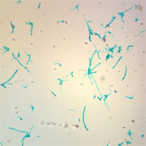 Moss Protonema Slide