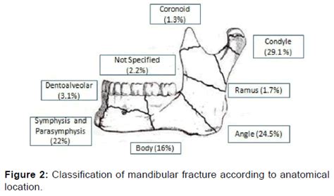 Mandibular Fracture Ppt Mandible Angle Fracture Powerpoint