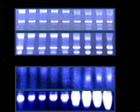 Time Course 0 Hour H To 8 Days After Imbibition DAI Native Gel Download Scientific Diagram