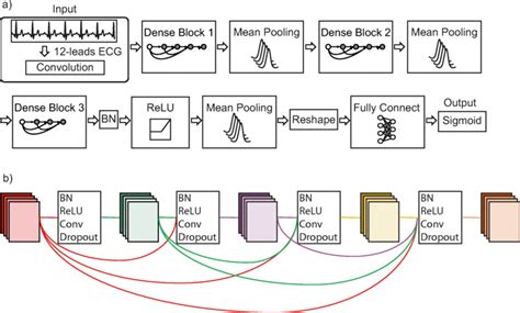 Densenet Architecture For Stroke Prediction With Ecg Traces A Download Scientific Diagram