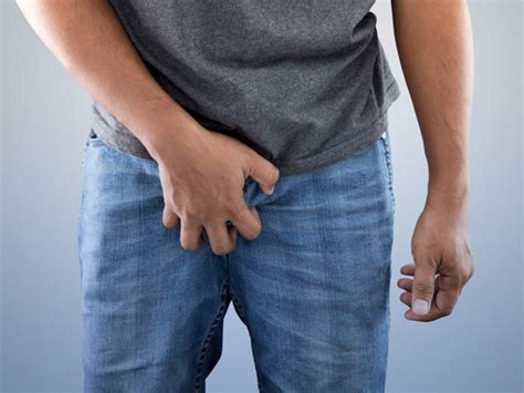 Yeast Infection On Scrotum