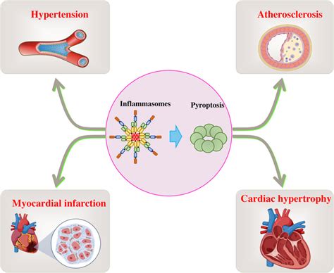 Pyroptosis Promotes The Occurrence Of Multiple Cardiovascular Diseases