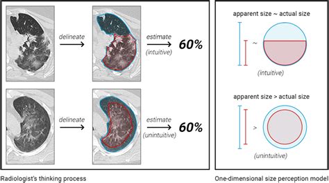 COVID 19 Quantification Judgement Process Left Compared To The Circle Download Scientific