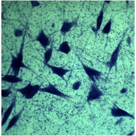 Forensics Prepared Slide Set Elementary And High School Prepared Slides Microscope Prepared Slides