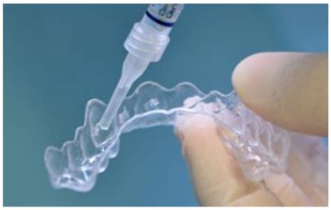 Applied Sciences Free Full Text Efficacy Of Carbamide And Hydrogen Peroxide Tooth Bleaching