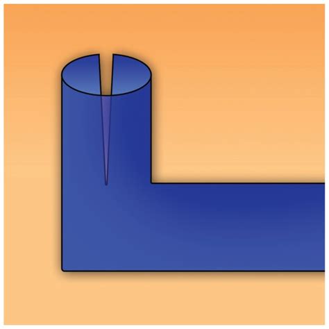 Jones One Snip Punctoplasty A Vertical Incision Is Made Along The Download Scientific Diagram