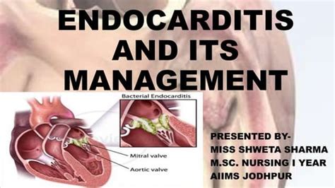 Endocarditis Ppt
