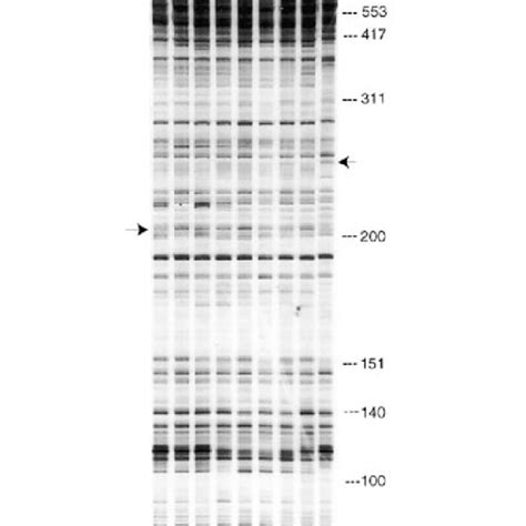 Analysis Of Cdna Fragments Identified By Mrna Differential Display Download Table