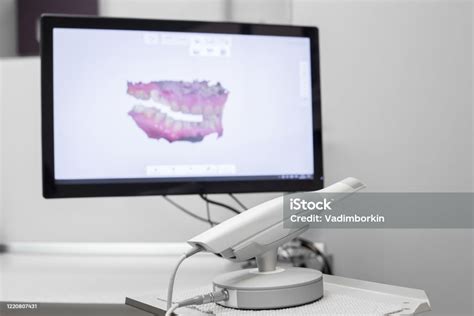 치과 진료소에서 치과 3d 스캐너 및 모니터 0명에 대한 스톡 사진 및 기타 이미지 0명 건강관리와 의술 모던 양식 Istock