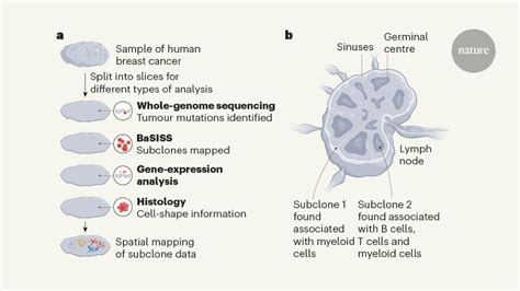 Breast Cancer Cells Diagram