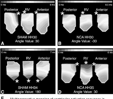 Figure 1 From Cardiac Neural Crest Ablation Inhibits Compaction And