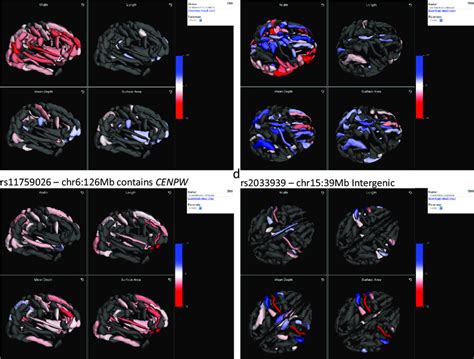 Three Dimensional Visualisation Of Brain Sulcal Associations