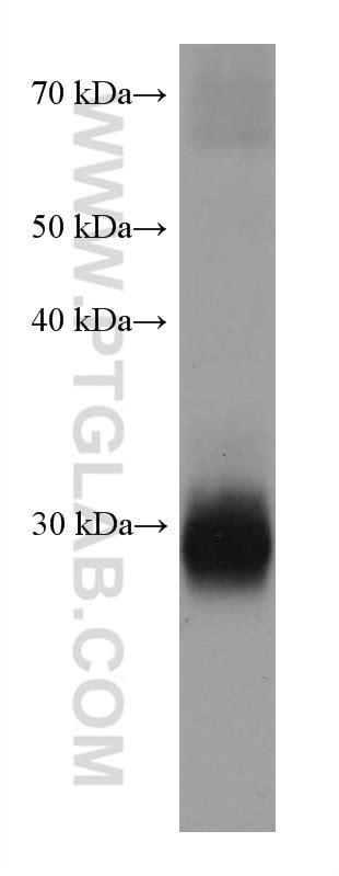 Cd40lcd154 Antibody 66502 1 Ig Proteintech