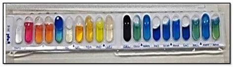 Api 20ne Strip Shows A Specimen Diagnosed As P Aeruginosa Download Api 20ne Strip Shows A Specimen Diagnosed As P Aeruginosa Download