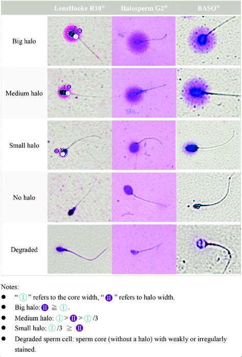 Comparison Of Three Scd Diagnostic Reagents In The Definition Of Five