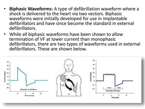 Understanding Defibrillation Waveforms Pptx Heart And Cardiovascular Diseases Diseases And