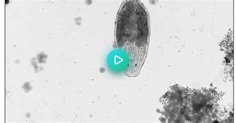 Flow Field Around A Microorganism Album On Imgur