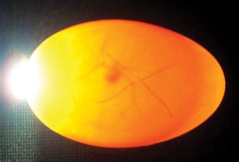 Candling Eggs And Advanced Techniques For Artificial Incubation And