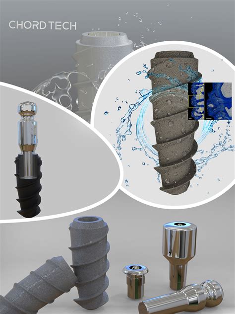 Niu牙科种植体 珠海乔丹科技股份有限公司 口腔种植体系统的研发及生产