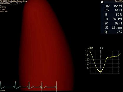 Lv Systolic Functionpptx