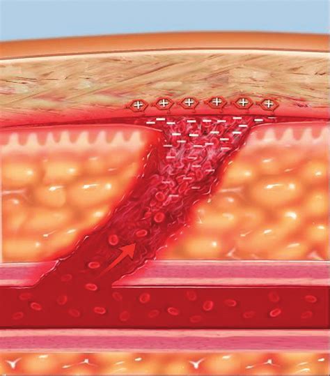 Chitosans Positive Charge Attracts Red Blood Cells Which Have A