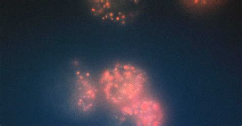 Photodynamic Therapy For Cancer