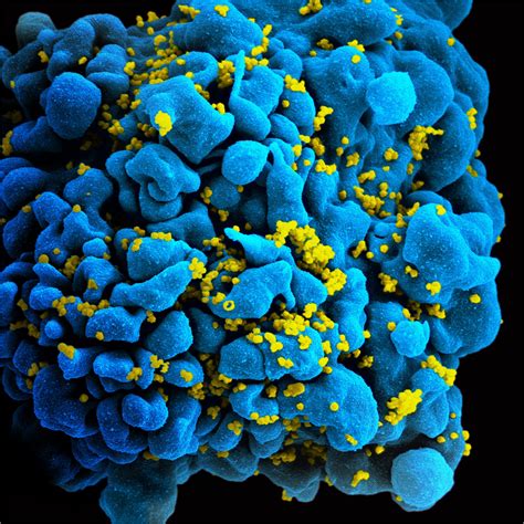 Hiv 1 Infected Cell The Image Shows A Microphotography Of An Infected Download Scientific