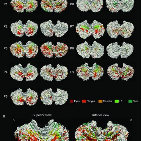 Pdf Whole Body Somatotopic Maps In The Cerebellum Revealed With 7t Fmri