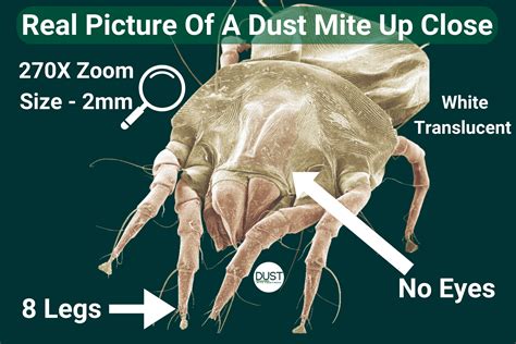 What Does A Dust Mite Look Like Up Close Idustmite