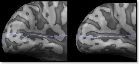 Mesh Reconstruction Simplification And Morphing Brain Innovation Resources Rainer S BV Blog