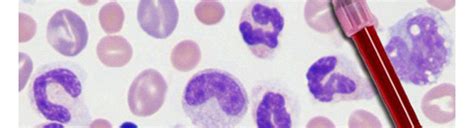 Immunophenotyping Tests