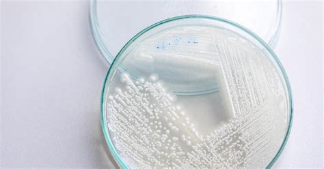 Yeast Engineered To Convert Methanol Into Heparin Research