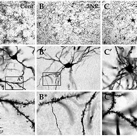 Effect Of 3np On Dendritic Spines Of Striatal Neurons And The