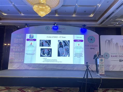 learn about enpp1 deficiency therapy ahmed magdi posted on the topic