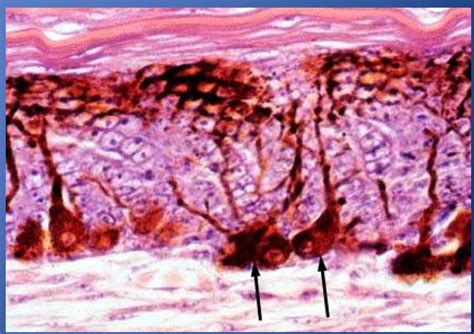 Integument Flashcards Quizlet