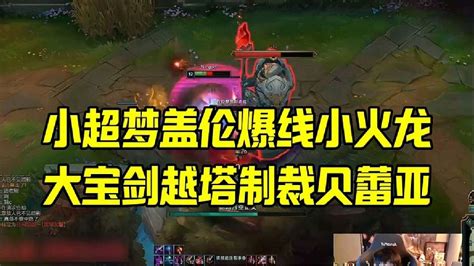 盖伦 搜索 专找直播 虎牙直播