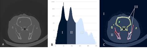 intensity based skull segmentation a slice of the acquired volume b