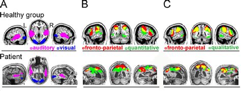 Decoding Executive Function In One Behaviorally Nonresponsive Patient